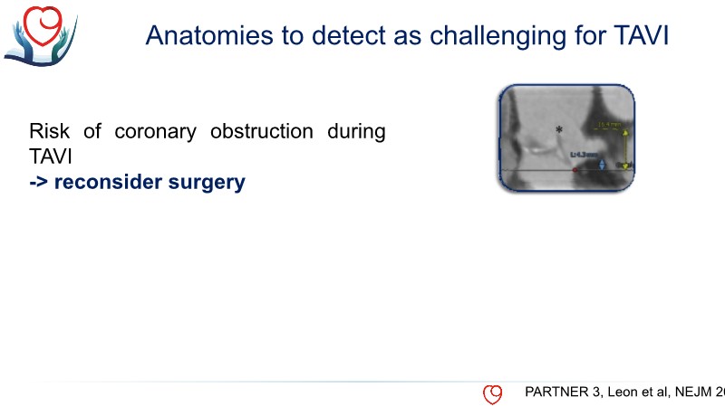 On lui propose un TAVI - | Cardio-online