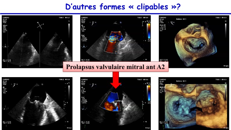 Présentation - | Cardio-online