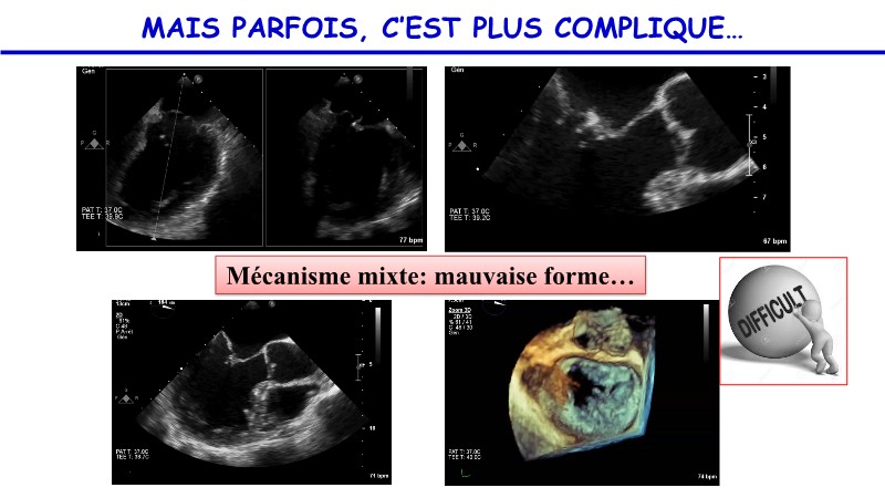 Présentation - | Cardio-online