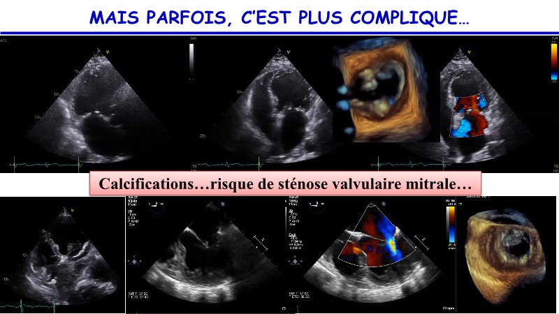 Présentation - | Cardio-online