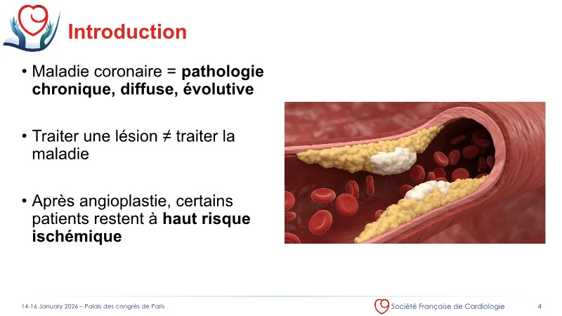 Un patient à haut risque ischémique - | Cardio-online